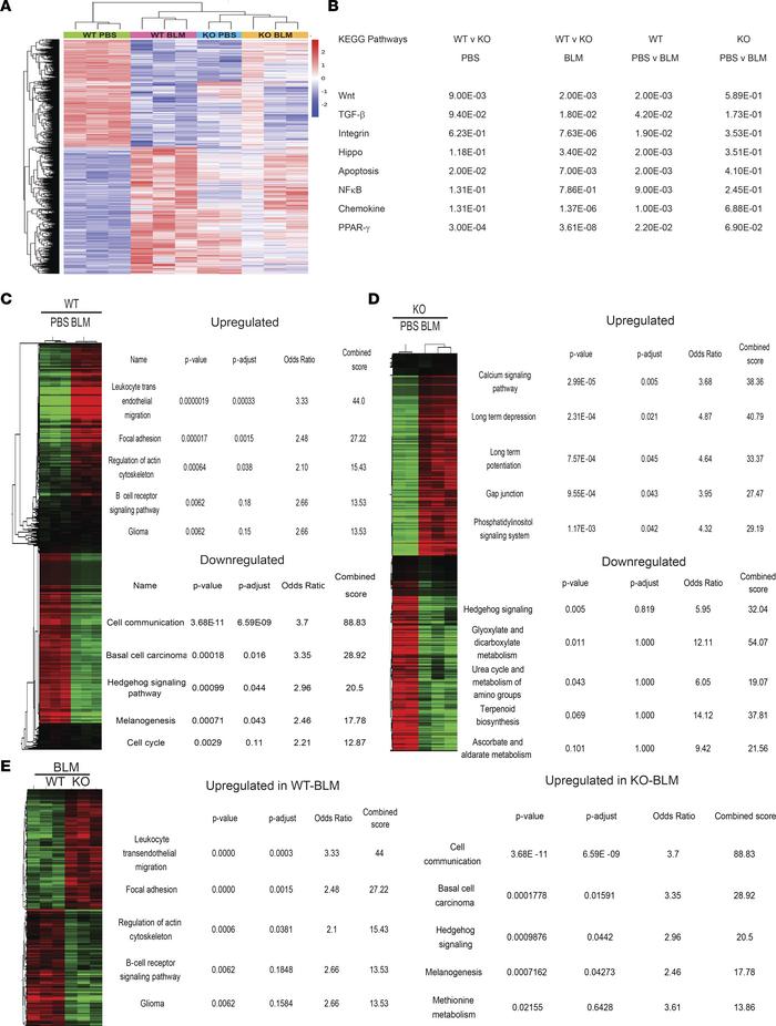 JCI Insight - Thy-1 plays a pathogenic role and is a potential ...