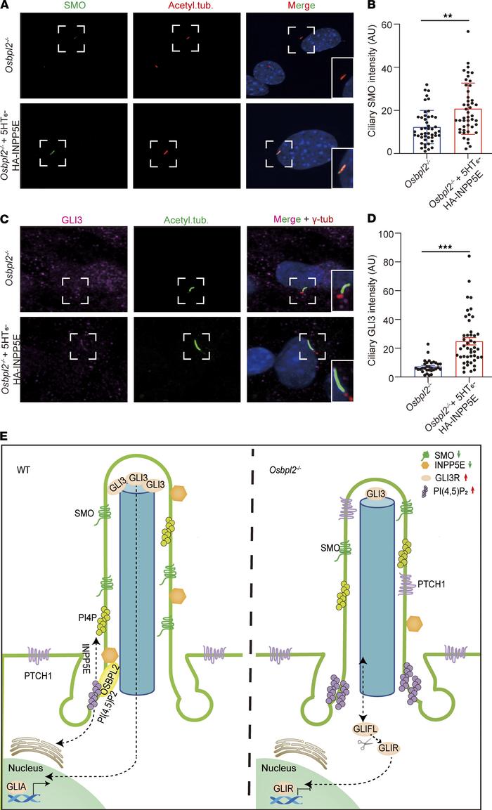 JCI Insight - Mutations in OSBPL2 cause hearing loss associated with ...