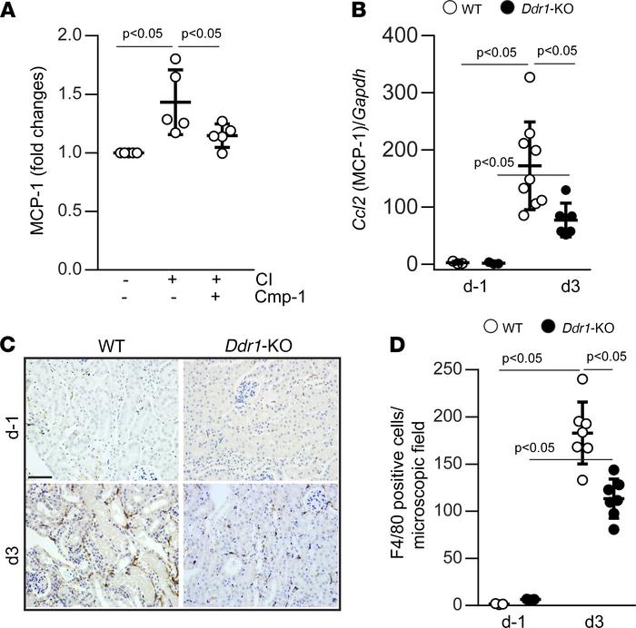 JCI Insight - DDR1 contributes to kidney inflammation and fibrosis by ...