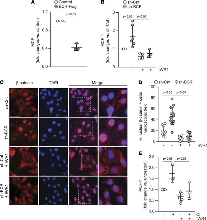 JCI Insight - DDR1 contributes to kidney inflammation and fibrosis by ...