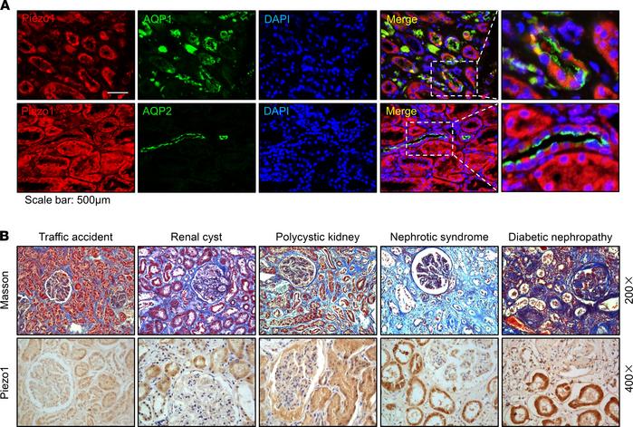 JCI Insight - Mechanosensitive Piezo1 channels mediate renal fibrosis