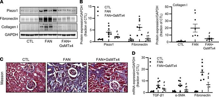 JCI Insight - Mechanosensitive Piezo1 channels mediate renal fibrosis