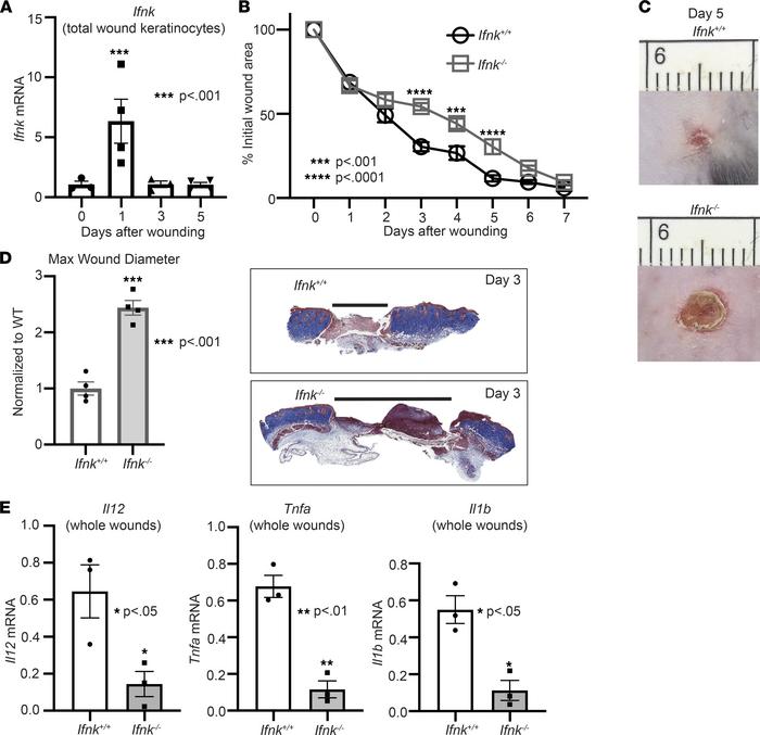 JCI Insight - IFN-κ is critical for normal wound repair and is ...