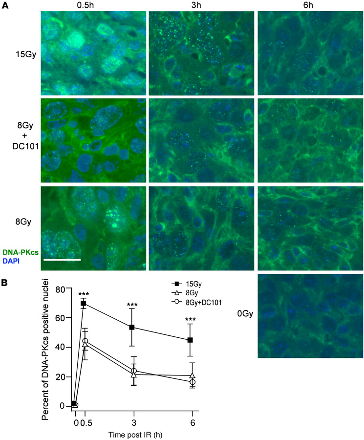 JCI Insight - Radiosensitizing the SUMO stress response intensifies ...