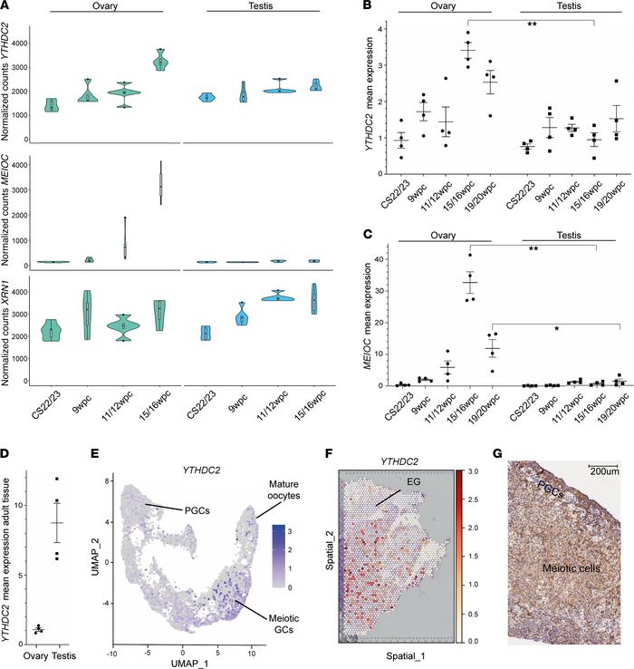 JCI Insight - Pathogenic variants in the human m6A reader YTHDC2 are ...