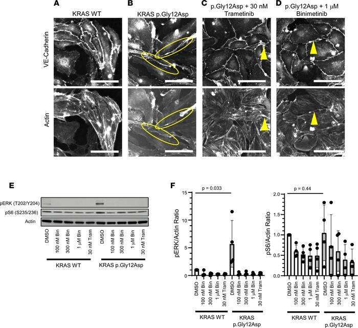 JCI Insight - Lymphatic disorders caused by mosaic, activating KRAS variants respond to MEK ...