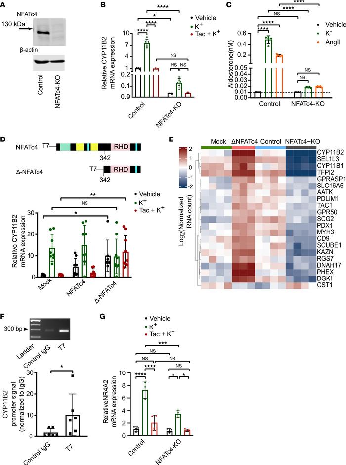 JCI Insight - Calcineurin regulates aldosterone production via ...