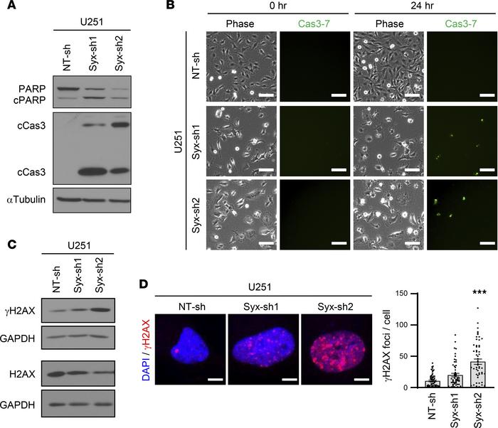 JCI Insight - A Syx-RhoA-Dia1 signaling axis regulates cell cycle ...