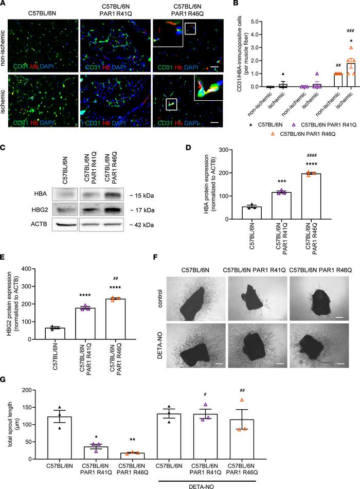 JCI Insight - EPCR-PAR1 biased signaling regulates perfusion recovery ...