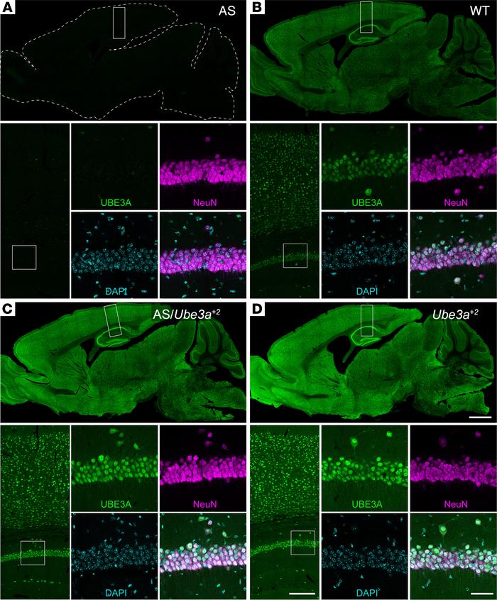 JCI Insight - Molecular and behavioral consequences of Ube3a gene ...