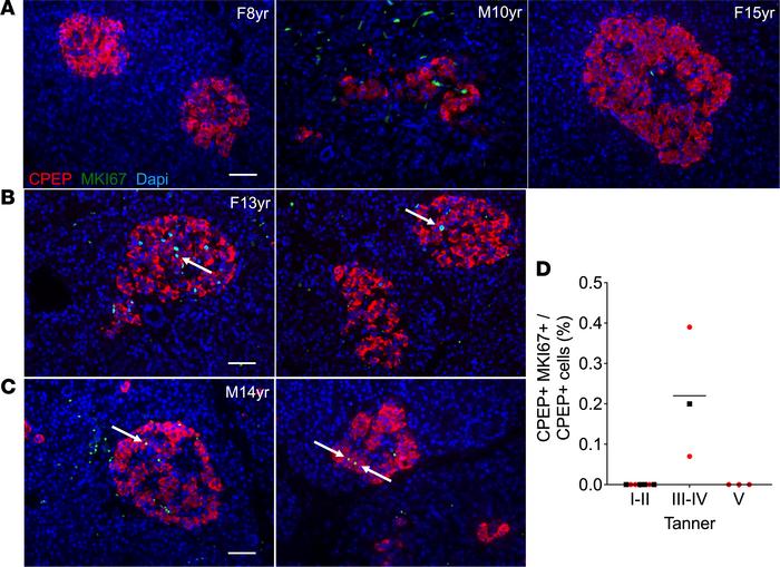 JCI Insight - β Cell mass expansion during puberty involves serotonin ...