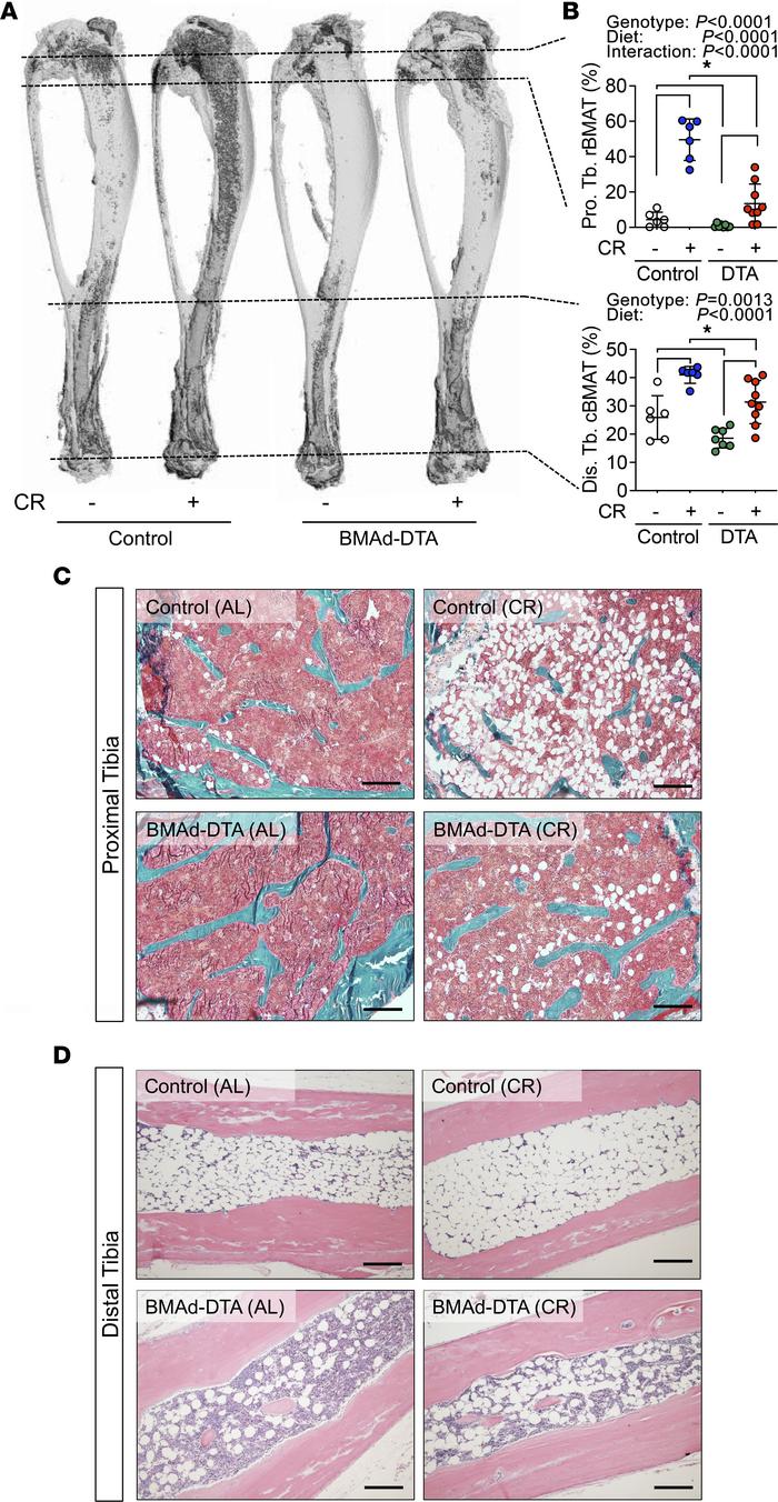 JCI Insight - Constitutive bone marrow adipocytes suppress local bone ...