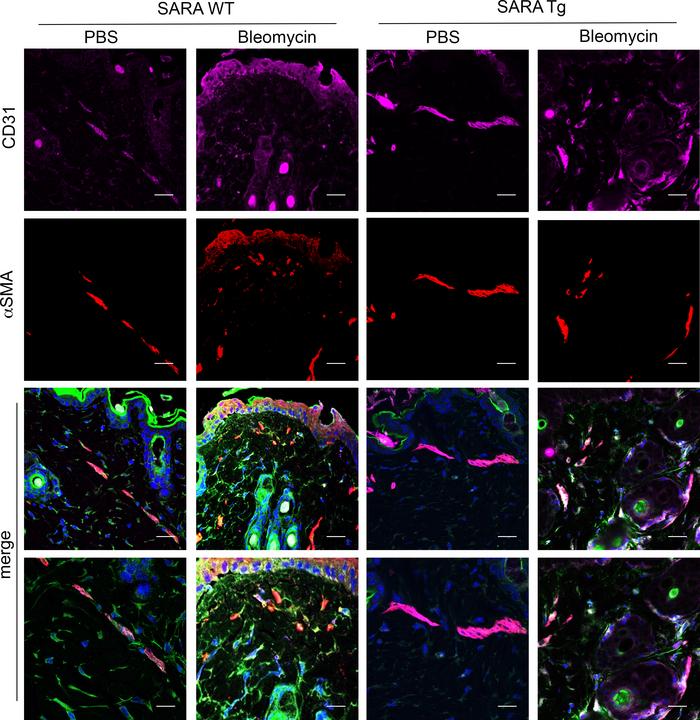 JCI Insight - SARA suppresses myofibroblast precursor ...