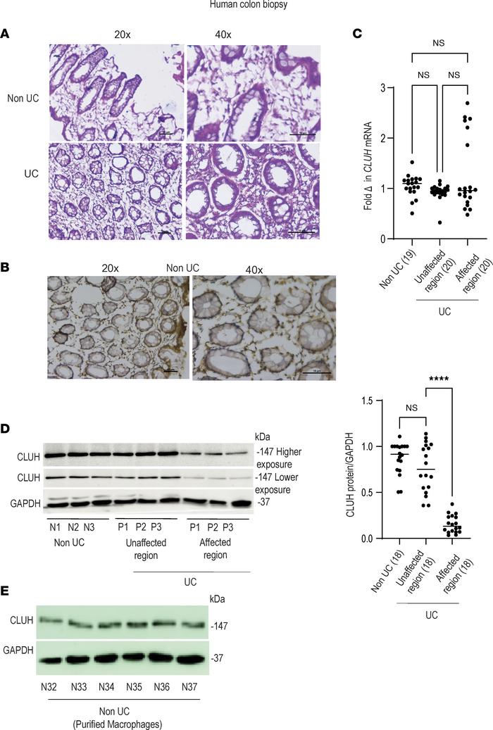 JCI Insight - CLUH functions as a negative regulator of inflammation in ...