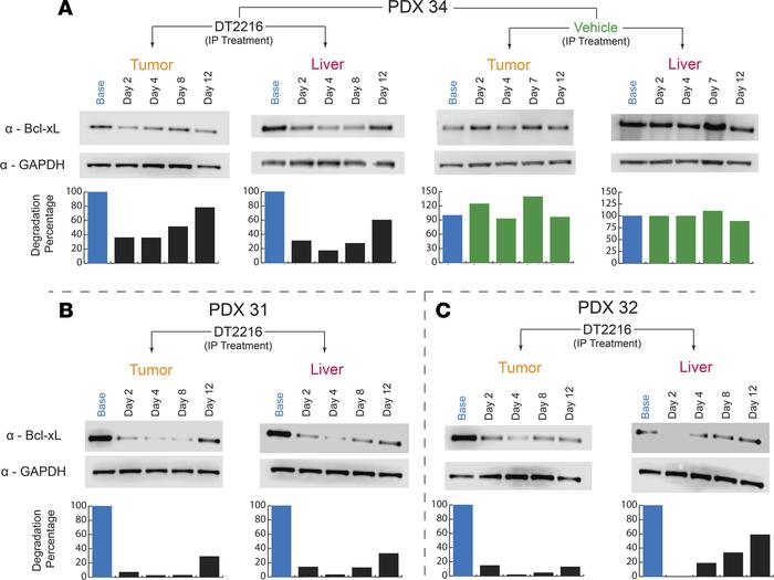 JCI Insight - Targeting BCL-XL in fibrolamellar hepatocellular carcinoma