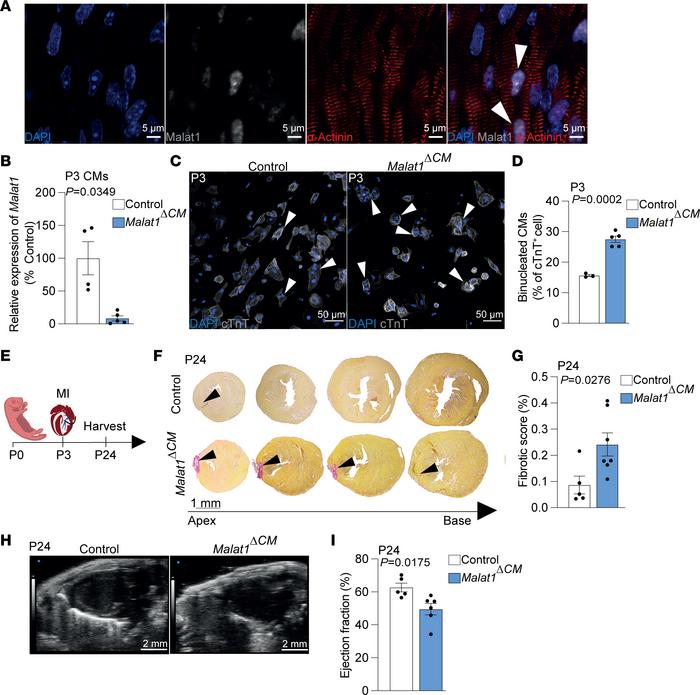 JCI Insight - Malat1 deficiency prevents neonatal heart regeneration by inducing cardiomyocyte ...