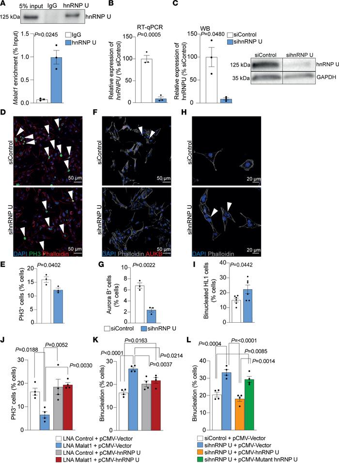 JCI Insight - Malat1 deficiency prevents neonatal heart regeneration by inducing cardiomyocyte ...