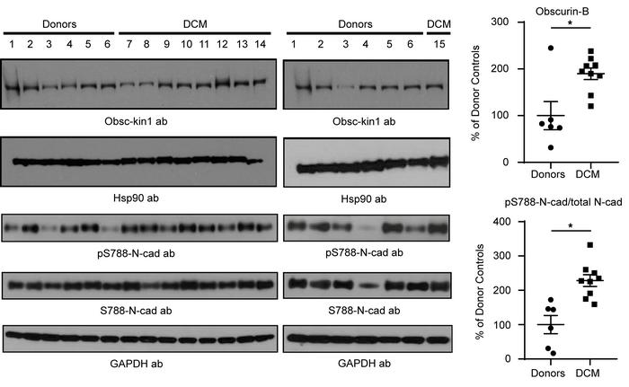 JCI Insight - Essential role of obscurin kinase-1 in cardiomyocyte ...