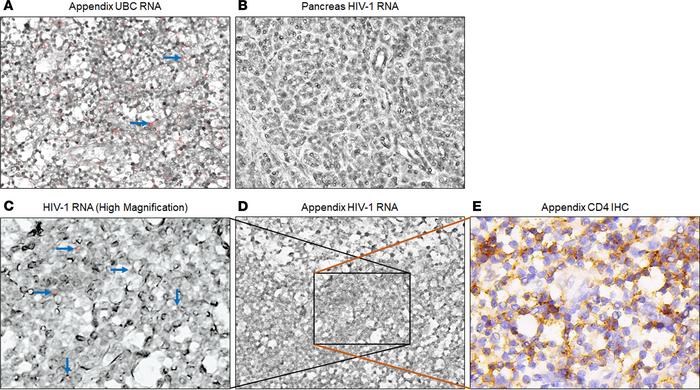 JCI Insight - Subtype C HIV-1 reservoirs throughout the body in ART ...