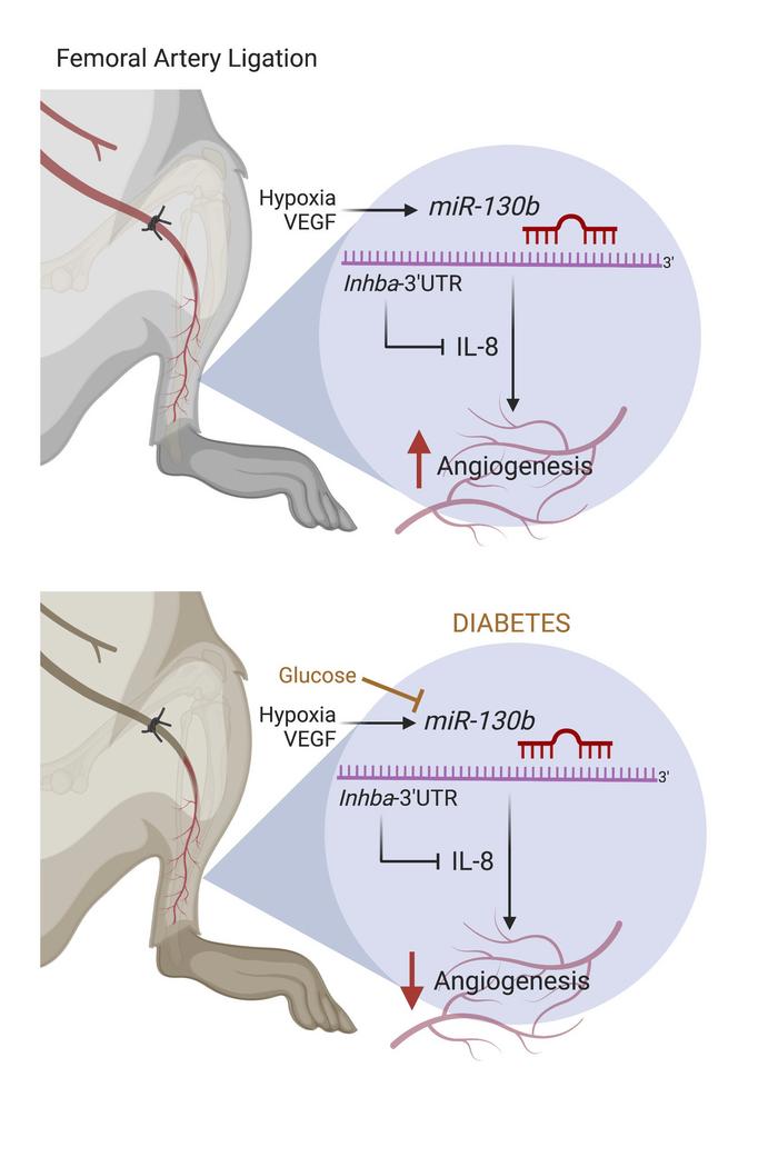 JCI Insight - Impaired angiogenesis in diabetic critical limb ischemia ...