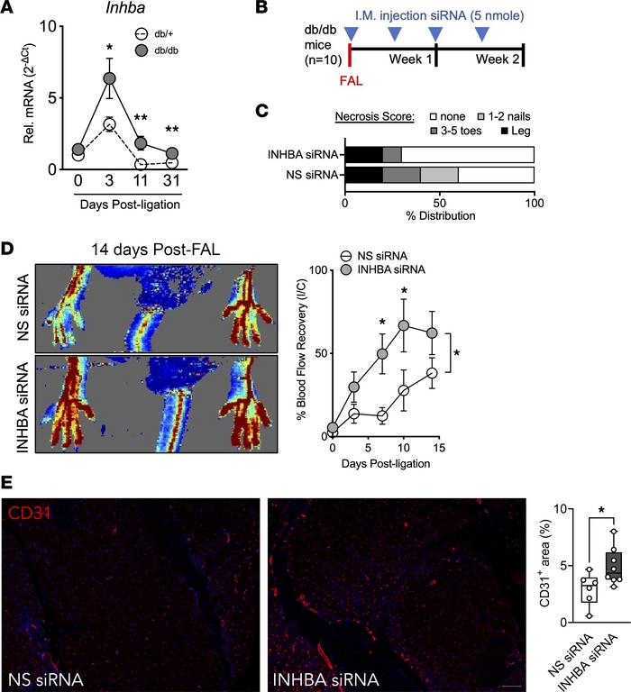 JCI Insight - Impaired angiogenesis in diabetic critical limb ischemia ...
