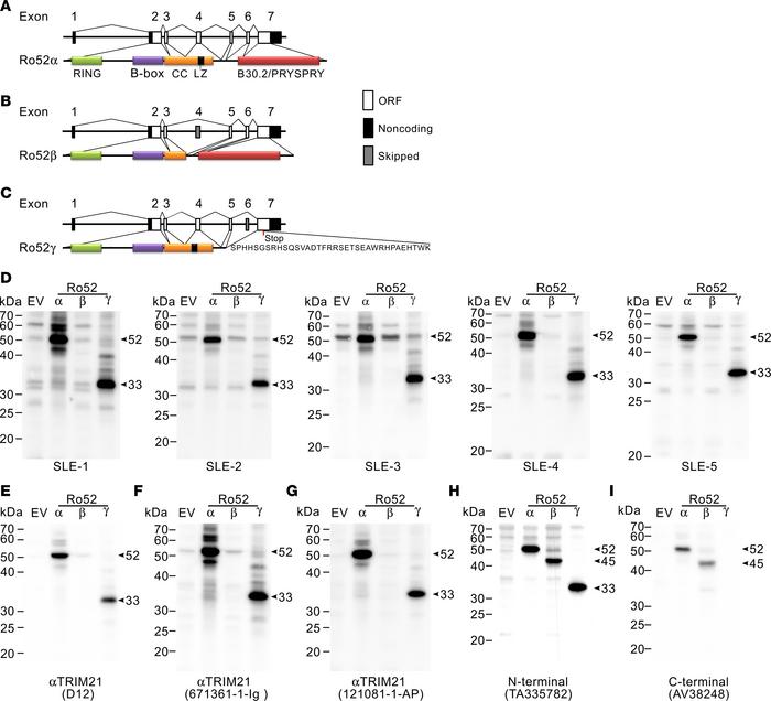 JCI Insight - Alternative exon usage in TRIM21 determines the ...