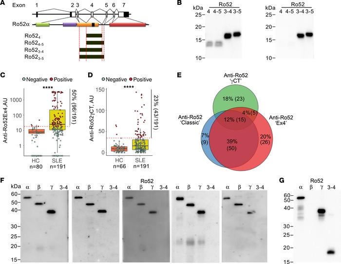 JCI Insight - Alternative exon usage in TRIM21 determines the ...