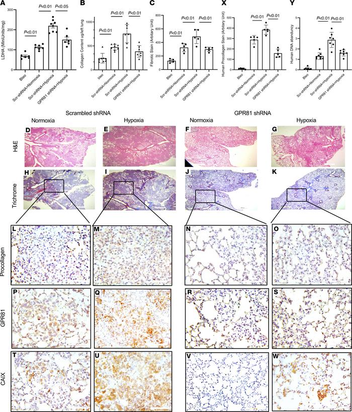 JCI Insight - Hypoxia enhances IPF mesenchymal progenitor cell ...