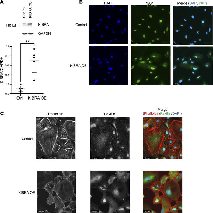JCI Insight - KIBRA upregulation increases susceptibility to podocyte ...