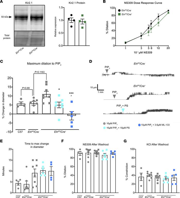 JCI Insight - Polarized localization of phosphatidylserine in the ...