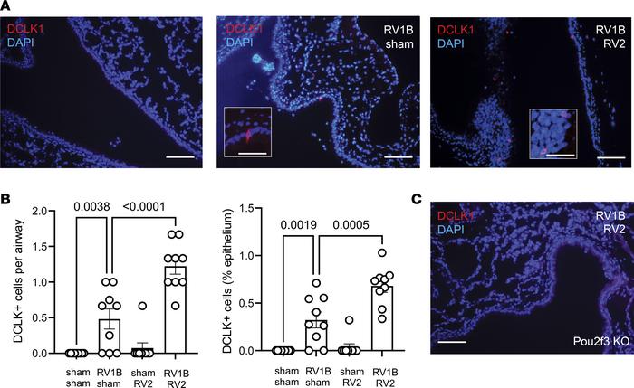 JCI Insight - Tuft cells are required for a rhinovirus-induced asthma ...