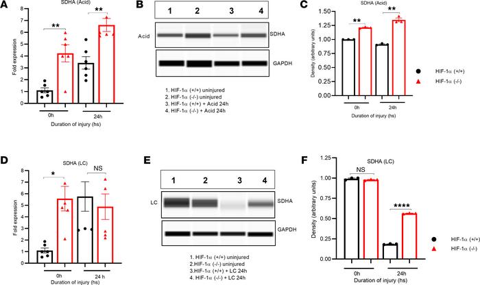 JCI Insight - Role of succinate in airway epithelial cell regulation ...