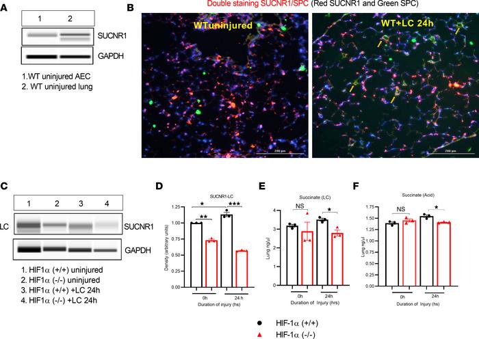 JCI Insight - Role of succinate in airway epithelial cell regulation ...