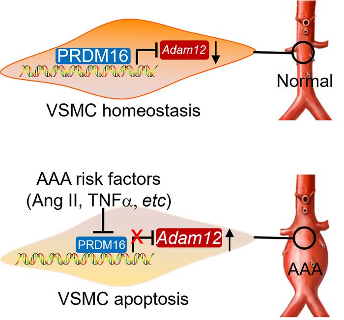 JCI Insight - PRDM16 deficiency in vascular smooth muscle cells ...