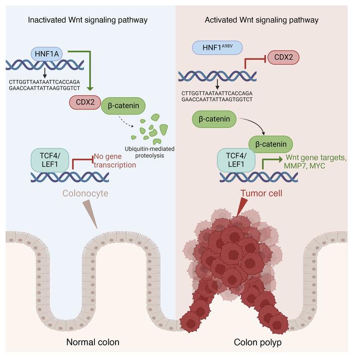 JCI Insight - High-fat diet plus HNF1A variant promotes polyps by ...