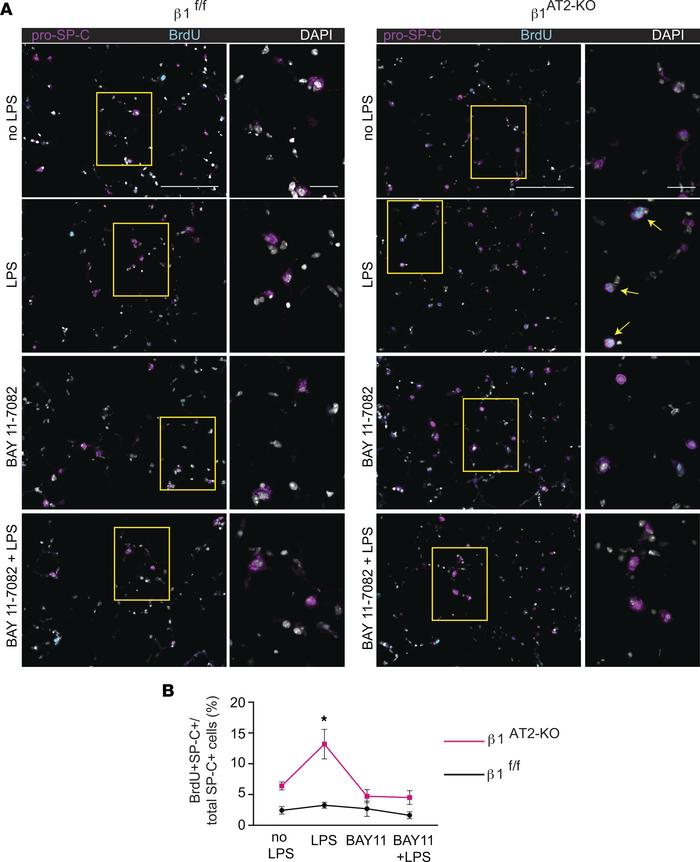 JCI Insight - Alveolar repair following LPS-induced injury requires ...