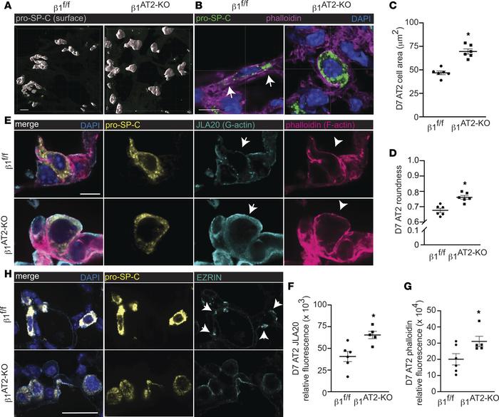 JCI Insight - Alveolar repair following LPS-induced injury requires ...