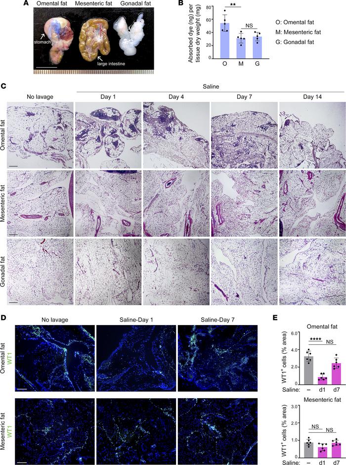 JCI Insight - Normal saline remodels the omentum and stimulates its ...