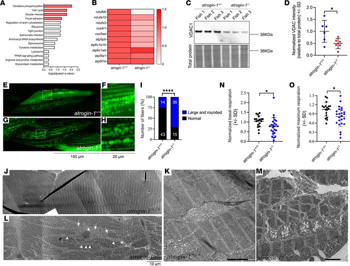 JCI Insight - Atrogin-1 promotes muscle homeostasis by regulating ...