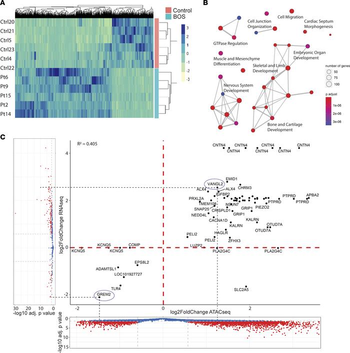 JCI Insight - Multiomics of Bohring-Opitz syndrome truncating ASXL1 ...