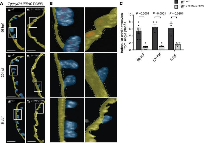 JCI Insight - Biallelic variants in FLII cause pediatric cardiomyopathy ...