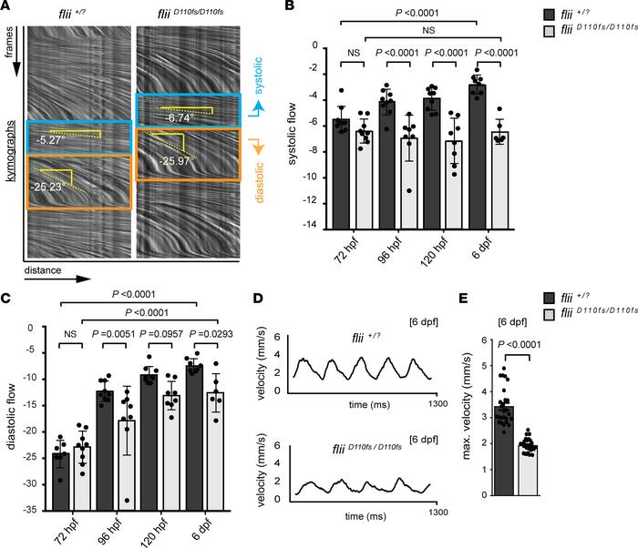 JCI Insight - Biallelic variants in FLII cause pediatric cardiomyopathy ...