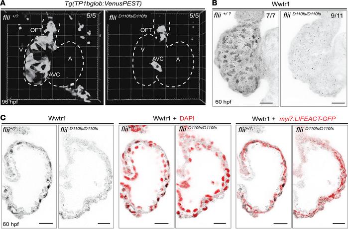 JCI Insight - Biallelic variants in FLII cause pediatric cardiomyopathy ...