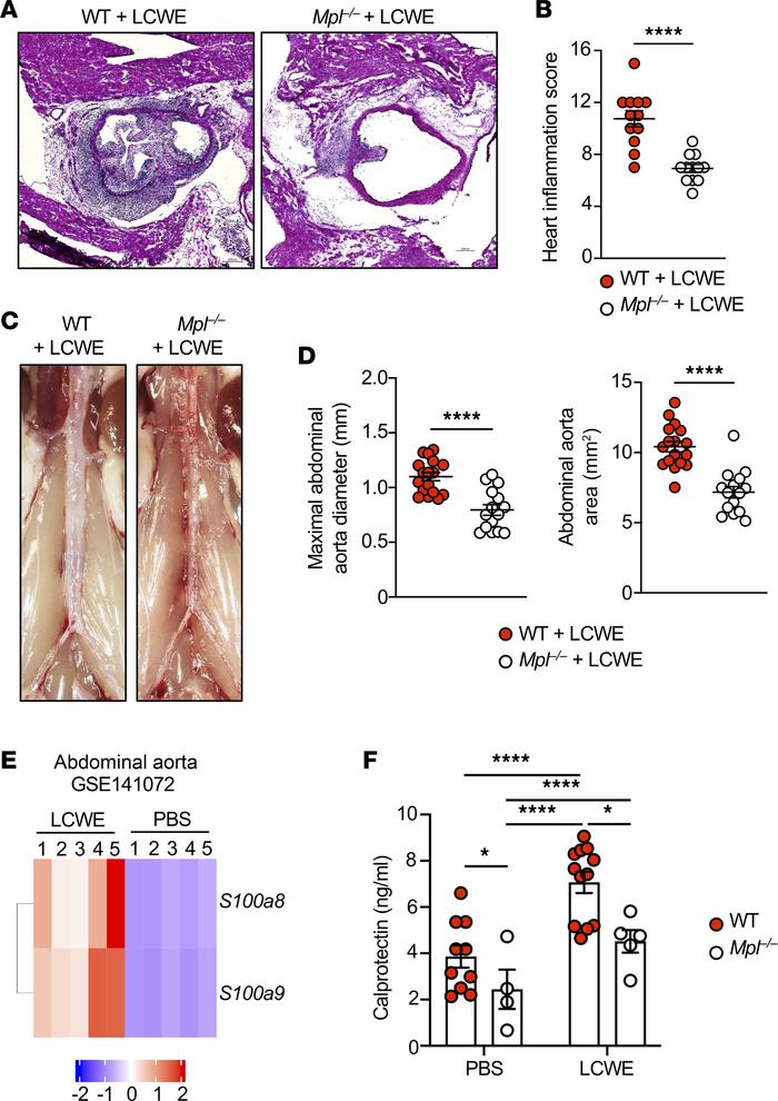 JCI Insight - Platelets exacerbate cardiovascular inflammation in a ...