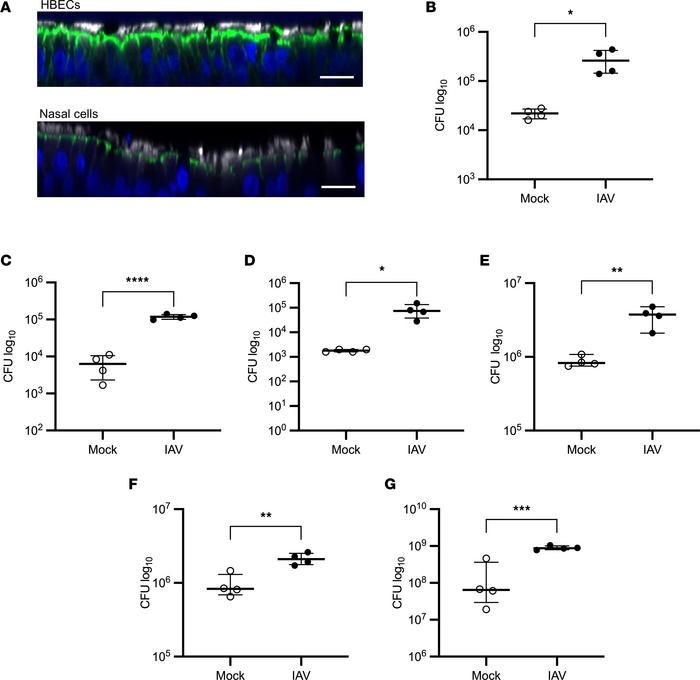 JCI Insight - Influenza A–induced cystic fibrosis transmembrane ...