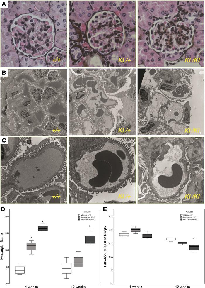 JCI Insight - Scaffold protein SH3BP2 signalosome is pivotal for immune ...
