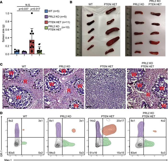 JCI Insight - PRL2 inhibition elevates PTEN protein and ameliorates ...