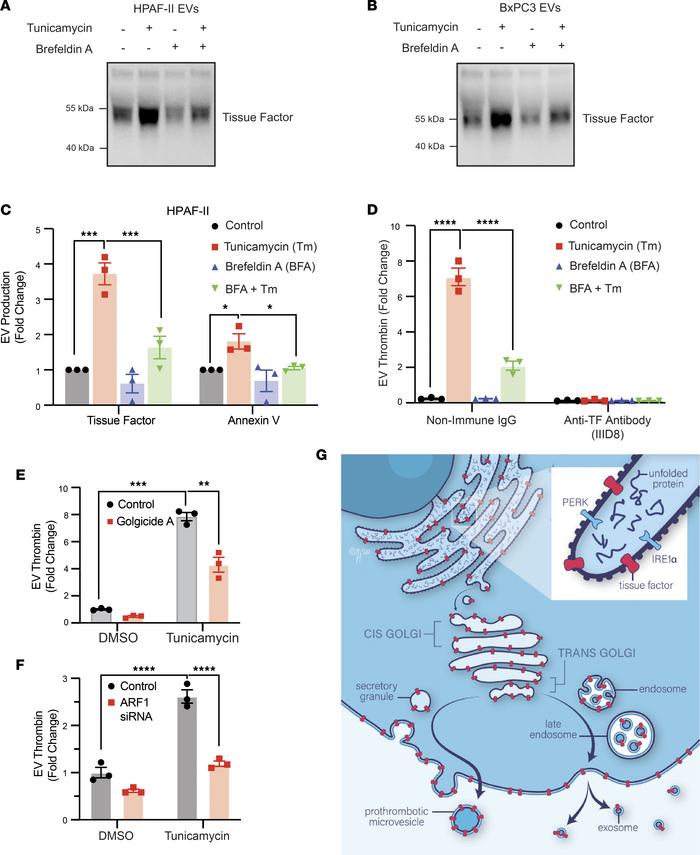 JCI Insight - The unfolded protein response links ER stress to cancer-associated thrombosis