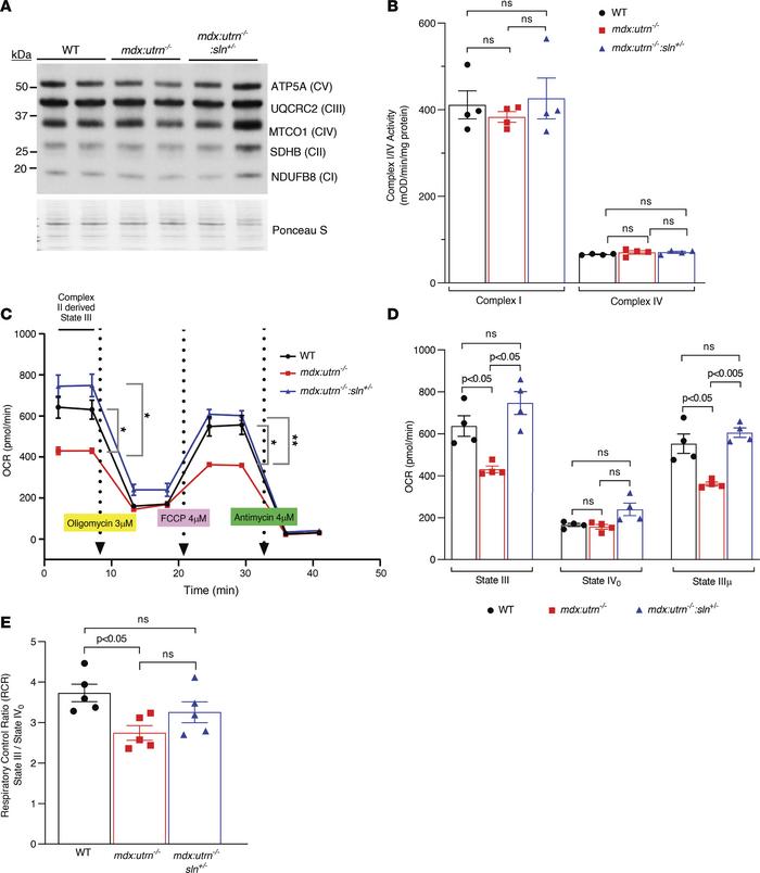 JCI Insight - Improved mitochondrial function in the hearts of ...