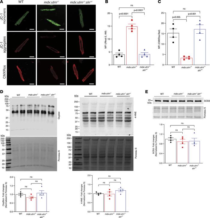 JCI Insight - Improved mitochondrial function in the hearts of ...
